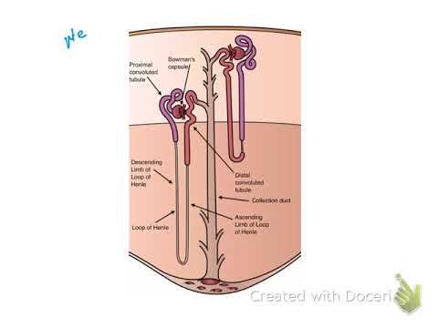 Renal Cell Carcinoma (clear cell carcinoma)