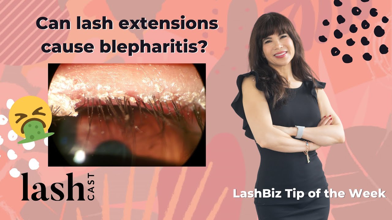 Can lash extensions cause blepharitis?