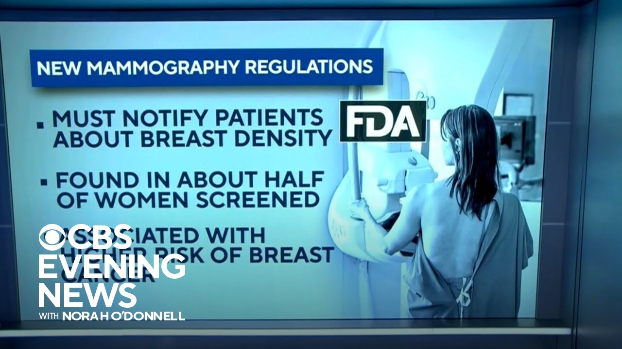FDA unveils new rules for mammograms