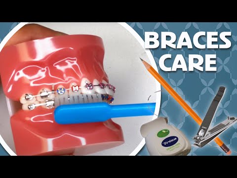 Braces Care & Instructions