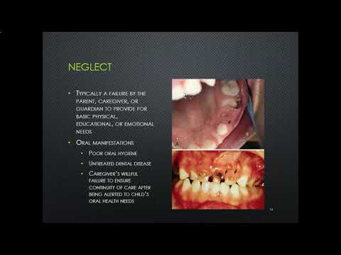 Child Abuse and Neglect 37 min