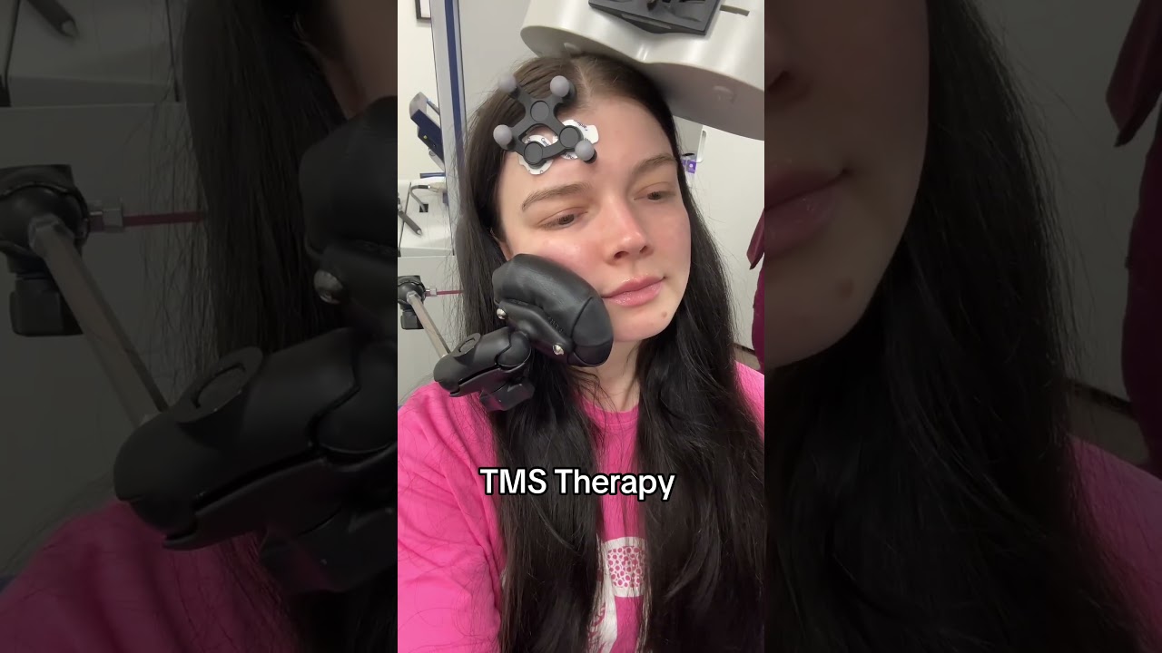 TMS therapy treatment! My sessions were 3 minutes long. #tmstherapy #tmstreatment #depression