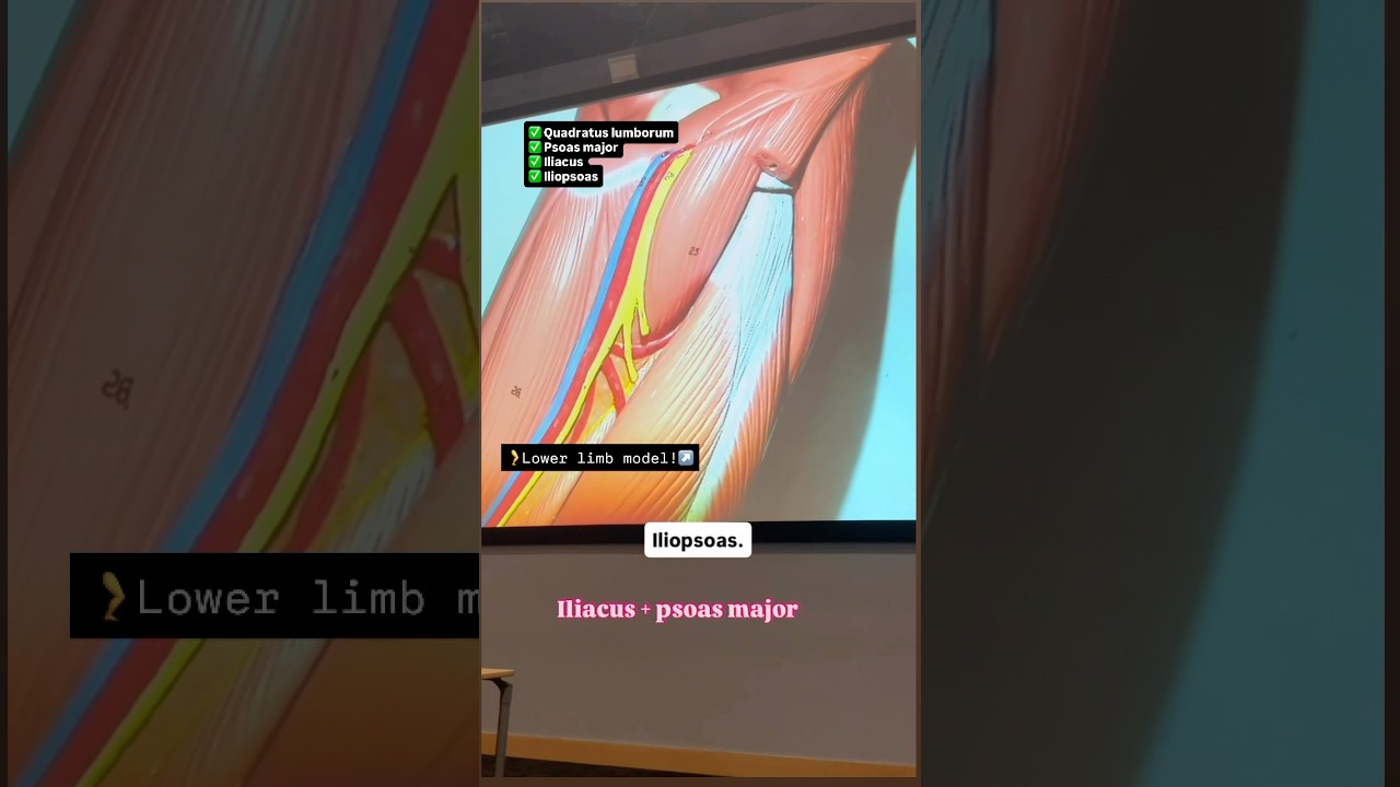 Muscles: ✅Quadratus lumborum, Psoas major, iIiacus, iliopsoas