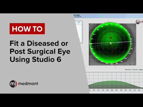 How To | Fit a diseased or post surgical eye (Studio 6)