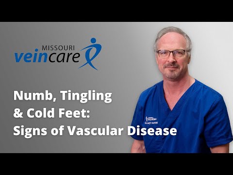 Are Numb, Tingling, and Cold Feet a Sign of Vascular Disease?