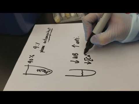 Coagulation: aPTT Test Part 1