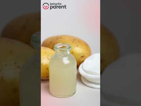 GET RID OF STRETCH MARKS FAST - Get Results in Just 7 Days With This Home Remedy!