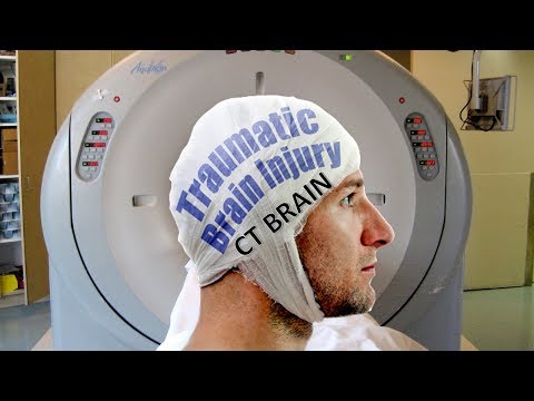 CT Brain in Head Injury