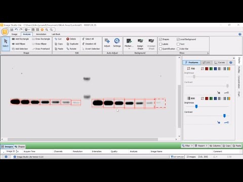 Defining Regions of Interest | Data Analysis and Basic Quantification