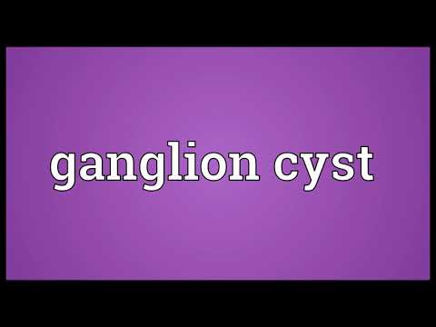 Ganglion cyst Meaning