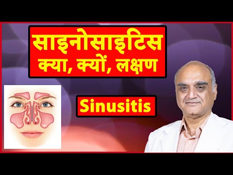 What is sinusitis । साइनोसाइटिस क्या है। साइनस किसे कहते हैं। Hindi