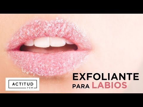 Labios resecos: causas y curas