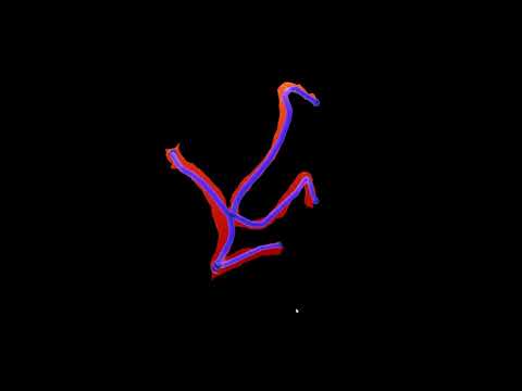 INVANER: INteractive VAscular Network Editing and Repair