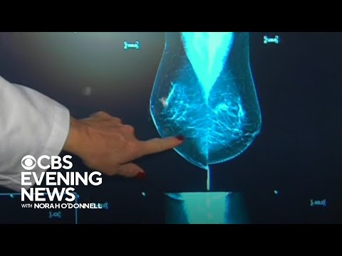 Breast density awareness is key in early cancer detection
