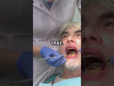 Does the VA cover dental implants?