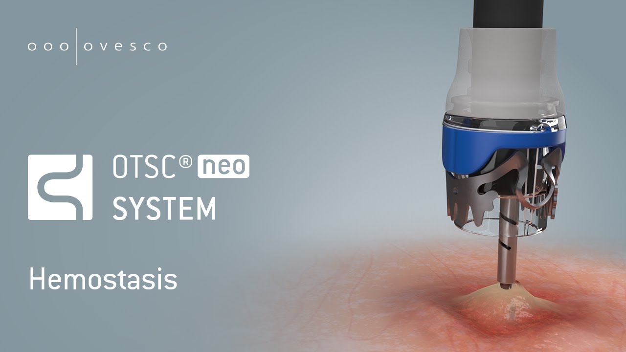 OTSC®neo | Hemostasis