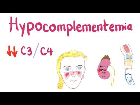 Hypocomplementemia (Low Plasma Complement Level) - Lupus