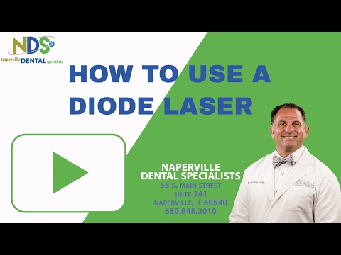 HOW TO USE A SOFT TISSUE DIODE LASER at Naperville Dental Specialists