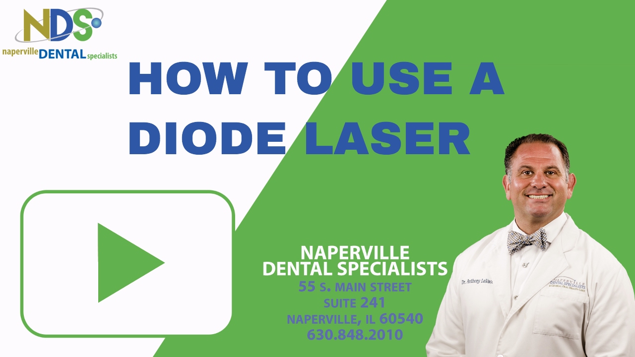 HOW TO USE A SOFT TISSUE DIODE LASER  at Naperville Dental Specialists