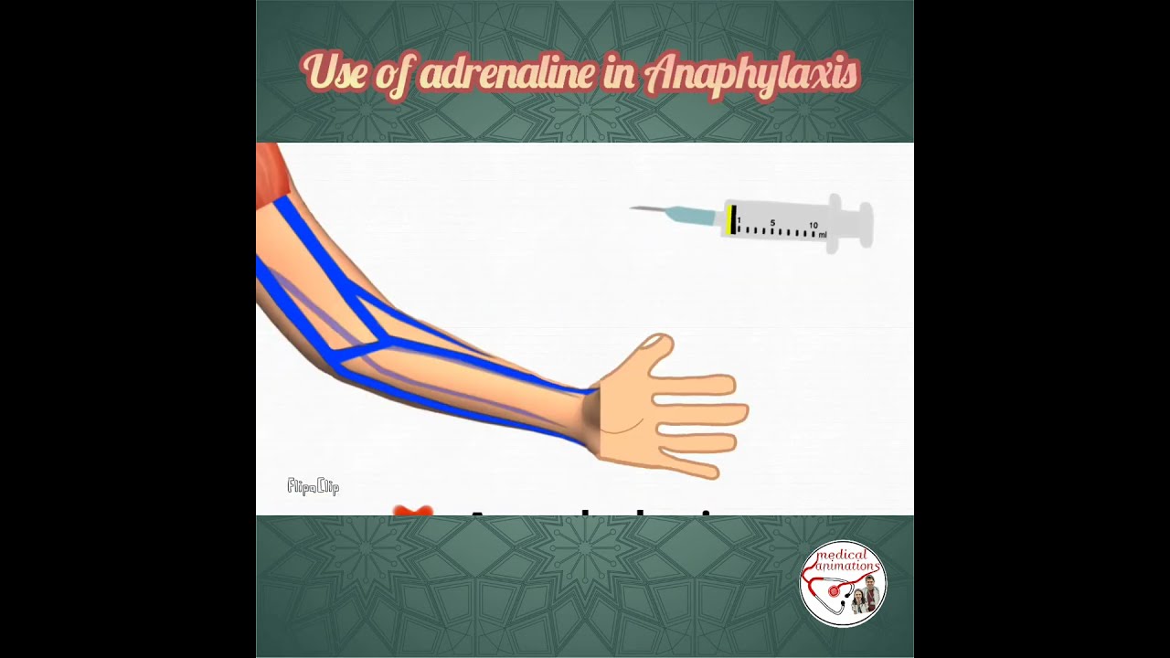💉 HOW TO USE ADRENALINE (EPINEPHRINE) IN ANAPHYLAXIS ? #pediatrics  #medicine #epinephrine