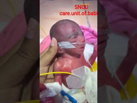 Little Premature baby Head ๐โโ๏ธ๐โโ๏ธ๐โโ๏ธ๐โโ๏ธ๐โโ๏ธ#viralvideo #trendingshorts #shortsviral