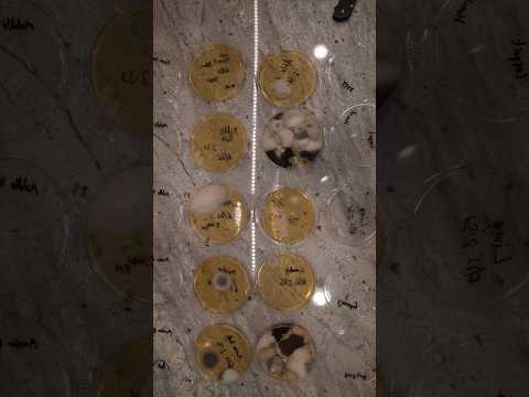 Do You Have a MOLD Problem? Testing Amazon Mold Kits