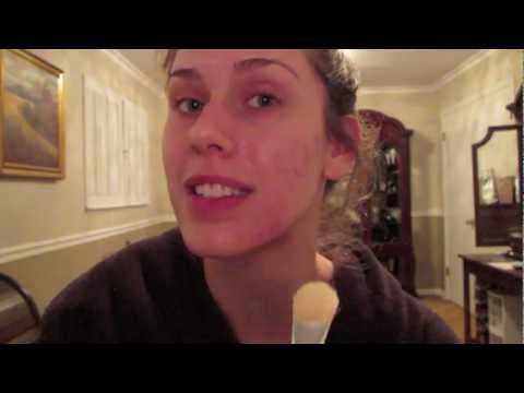 Talkin Tuesday! What Its Like To Get A Glycolic Peel/How It Feels/Steps