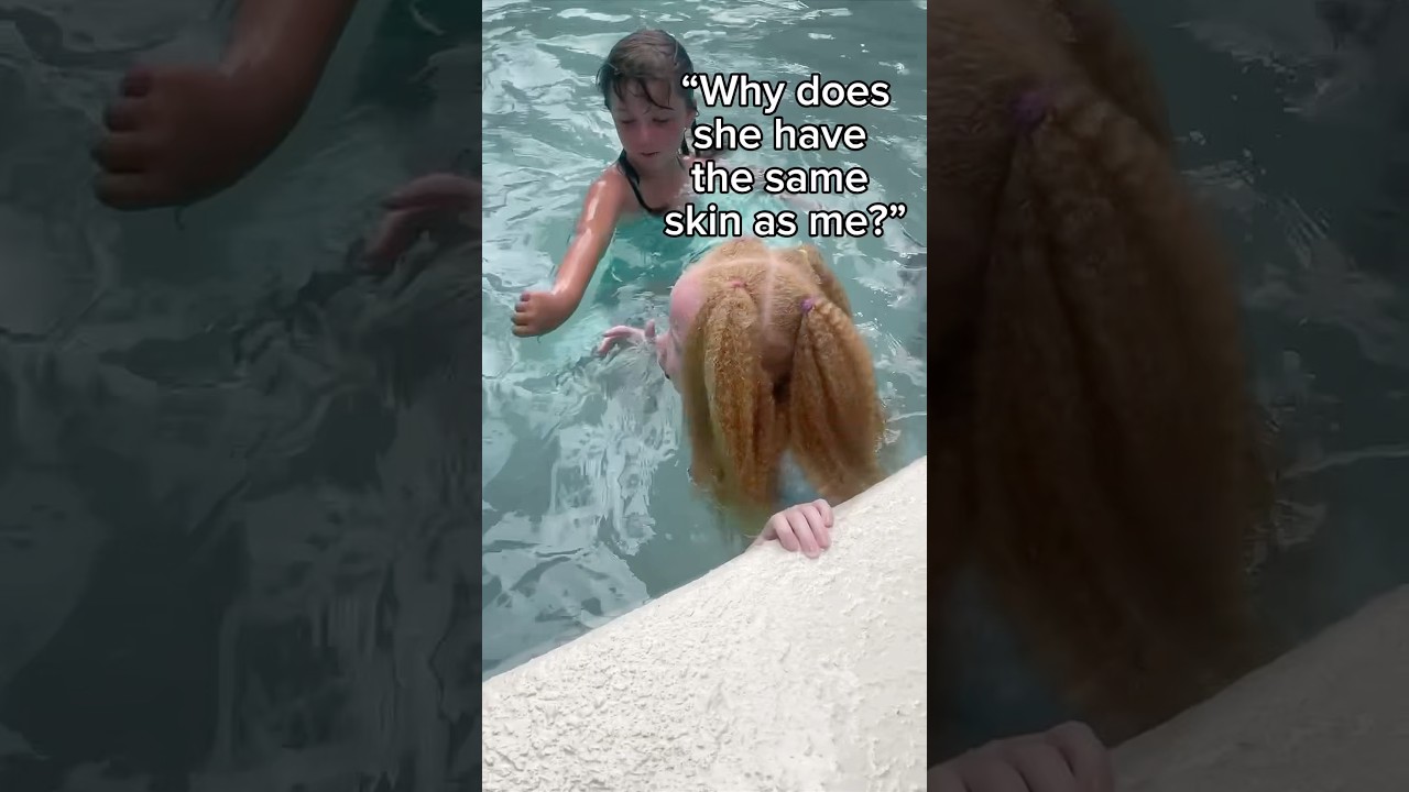 I get this question a lot from kids - “Is that your child?” #albinism #albino