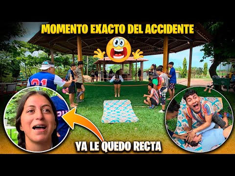 Kathy no necesito de una operación en sus nariz para que le quedará perfecta. Divertido salto