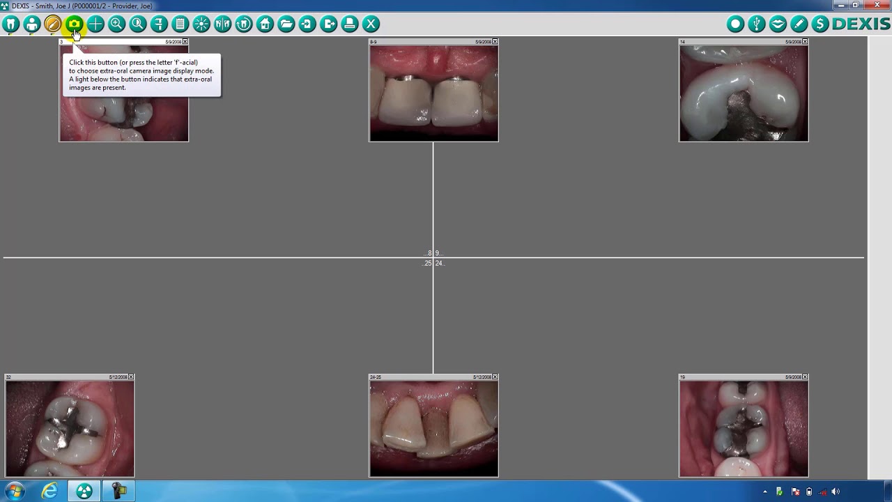 DEXIS™ Imaging Suite Toolbar Overview - Part One