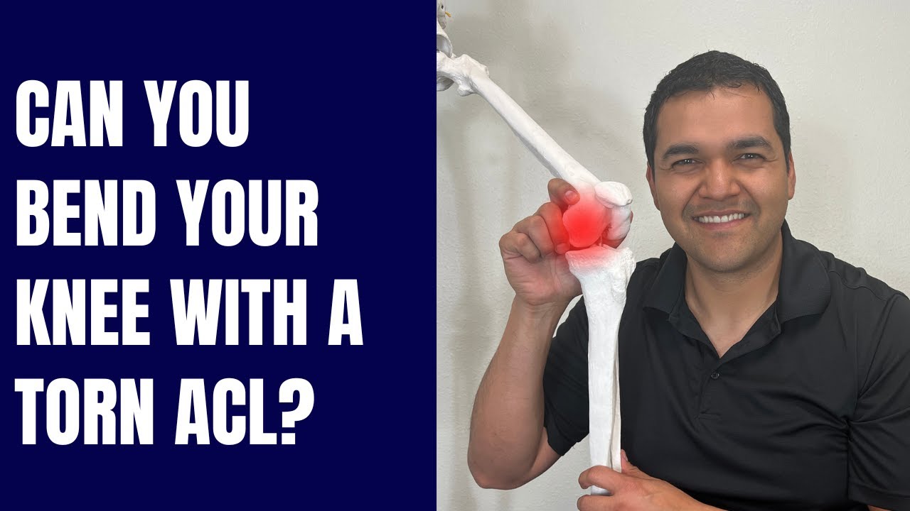 Can You Bend Your Knee With a Torn ACL?