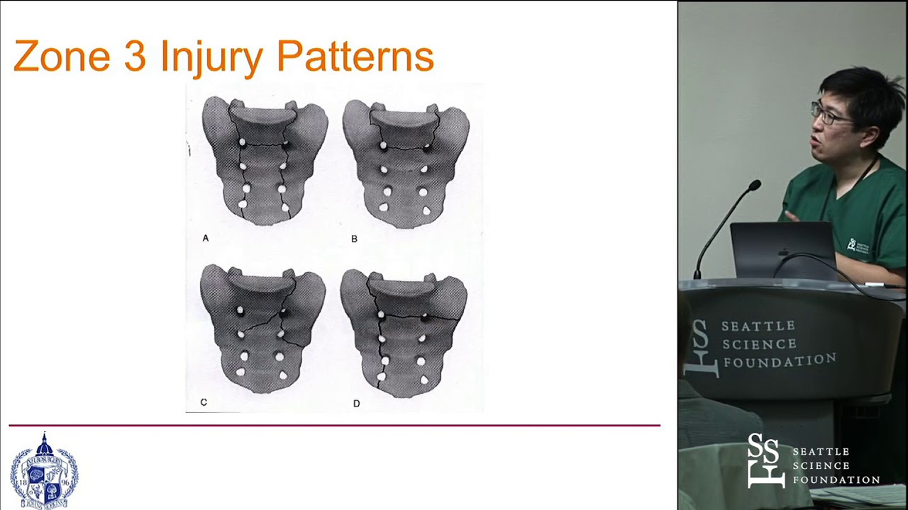 Sacral Fracture Management 101 - Sheng-fu (Larry) Lo, MD, MHS