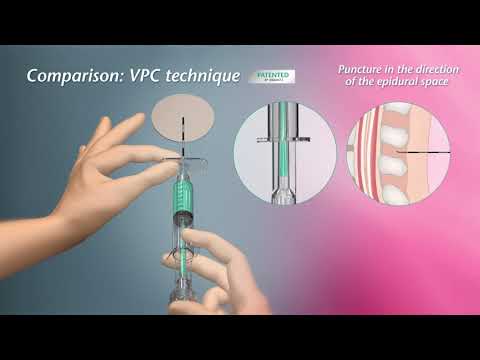 EpiLong VPC