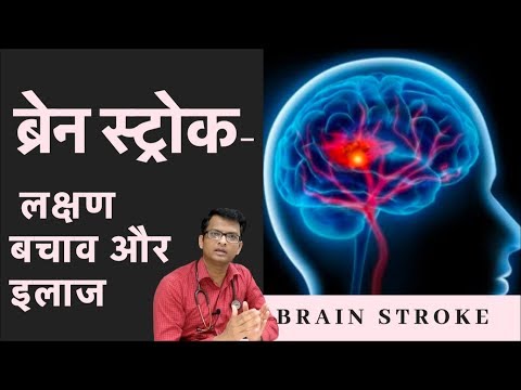 Brain Stroke in Hindi | ब्रेन स्ट्रोक- लक्षण बचाव और इलाज