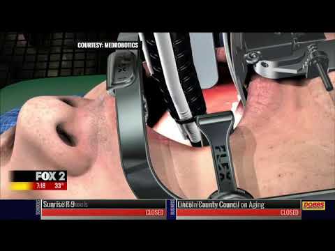 Flex Robotic Surgery at SSM Health SLU Hospital