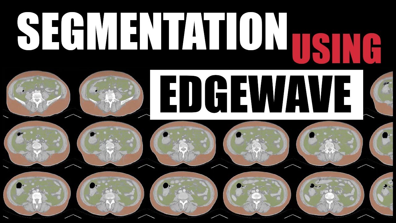 FireVoxel Tutorial 6: Introduction to EdgeWave Segmentation