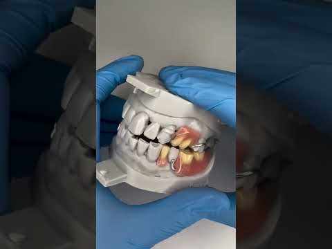 Top U.S. Dental Lab for advanced implant restorations & full-arch solutions! ๐