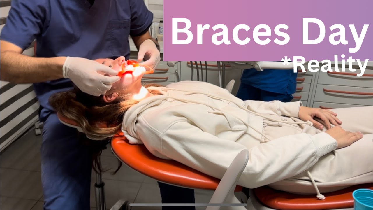 BRACES DAY (REALITY-ASMR-PAIN-HAUL)