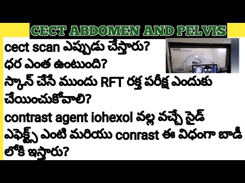 cect abdomen in telugu,iohexol telugu,omnipaque injection uses.contrast injection side effects.