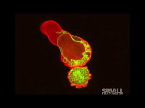 Melanoma (Skin-Cancer) Non-adhered Cells | 2017 Nikon Small World