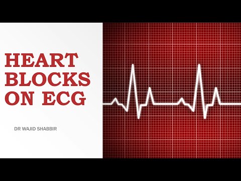 Heart blocks made easy |heart blocks in urdu | heart blocks ECG