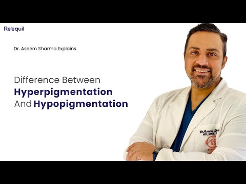 Difference Between Hyperpigmentation And Hypopigmentation - By Dr Aseem Sharma