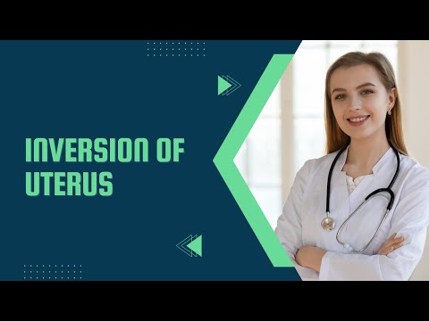 Inversion of Uterus: Causes, Symptoms, Diagnosis & Treatment | Animated Video