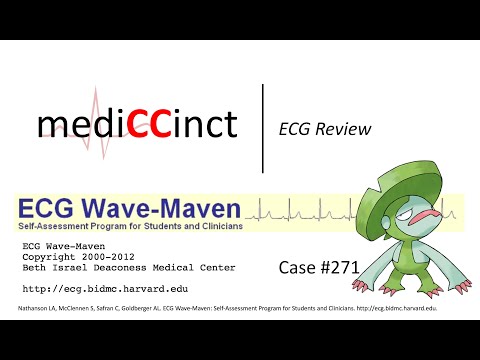 Ectopic Atrial Rhythm (ECG Wave-Maven) Case #271