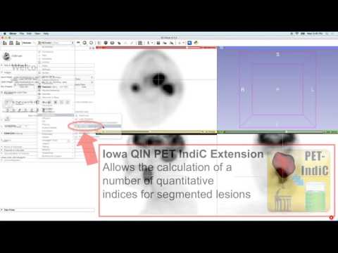 Positron Emission Tomography (PET) quantification using 3D Slicer