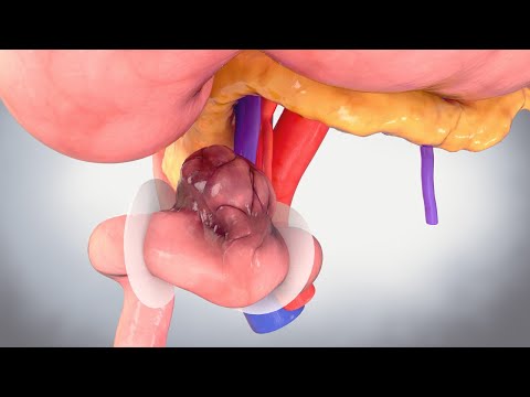 CPT code for Resection - simplify medical coding