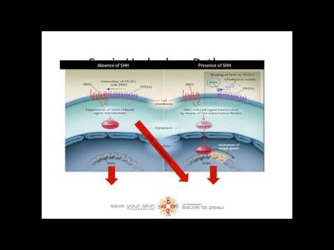 Educational Video Series: What is Basal Cell Carcinoma (BCC)