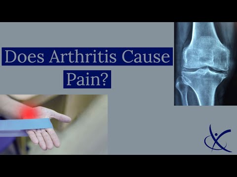 Does Arthritis Cause Hurt? - Does Pain Mean I have Arthritis?
