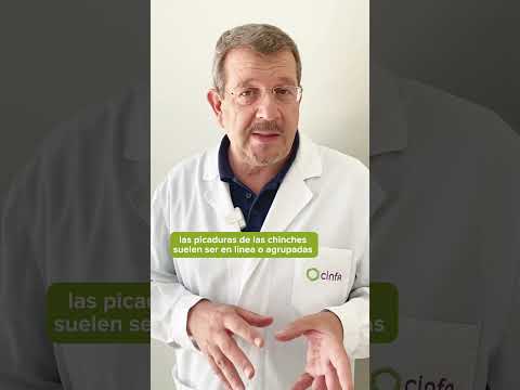 ¿Cómo reconocer las #picaduras de las #chinces de cama?