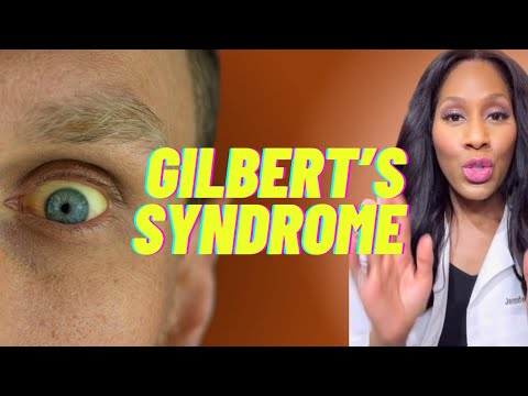 What is Gilbert’s Syndrome? What Are the Symptoms of Gilbert’s Syndrome? A Doctor Explains